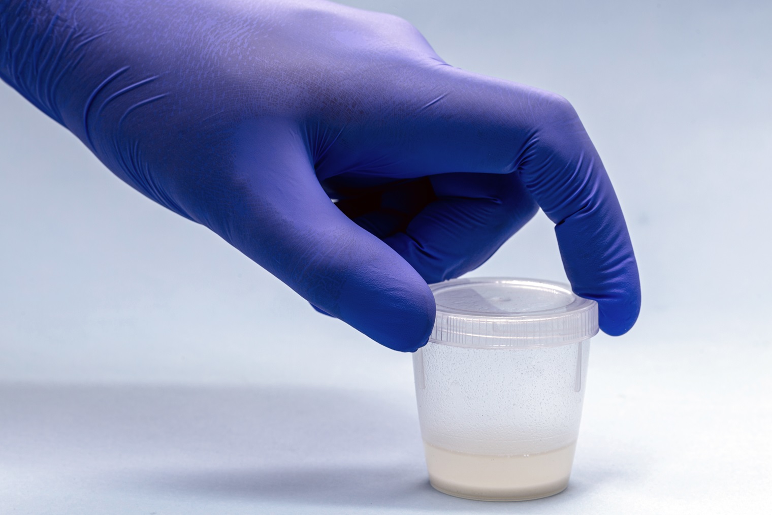 Fertility Screening | LIFESURE FERTILITY AND GYNAECOLOGY CENTRE